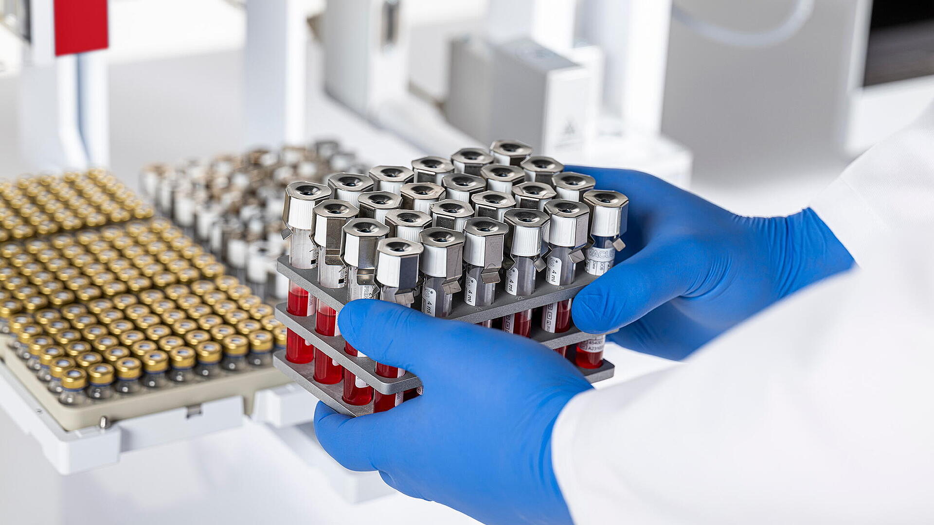 clinPAL - Preparation of clinical samples with ICP-MS - Analytik Jena
